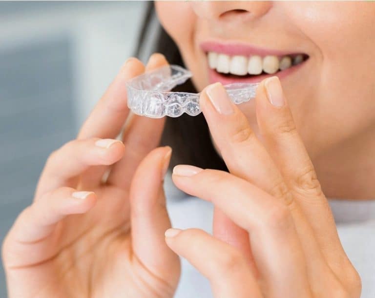 Invisalign Review - Pretty Me Philippines